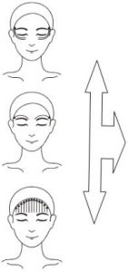 RF Operation skills /How to operate RF for different areas treatment ...