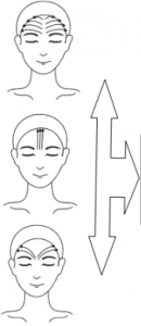 RF Operation skills /How to operate RF for different areas treatment ...